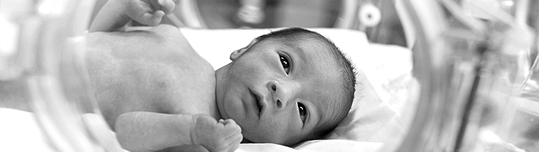 Radiometer introduces MicroMode measuring for fetal scalp and neonatal ...